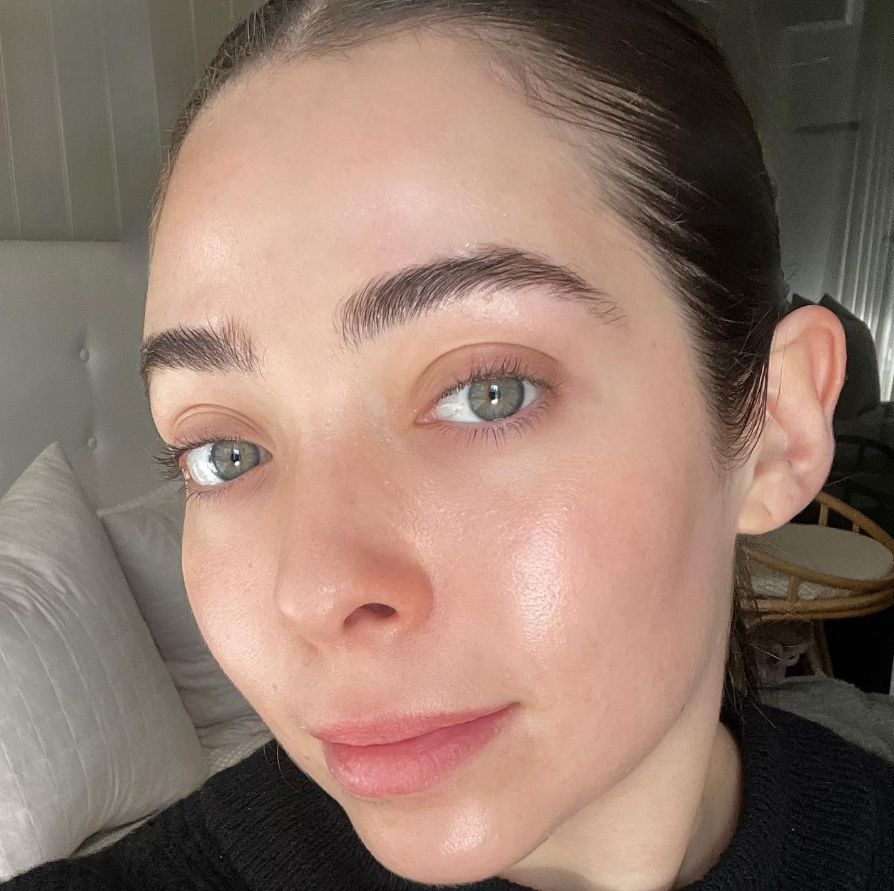 A Must-Try Treatment For Radiant Skin – Ultraceuticals US