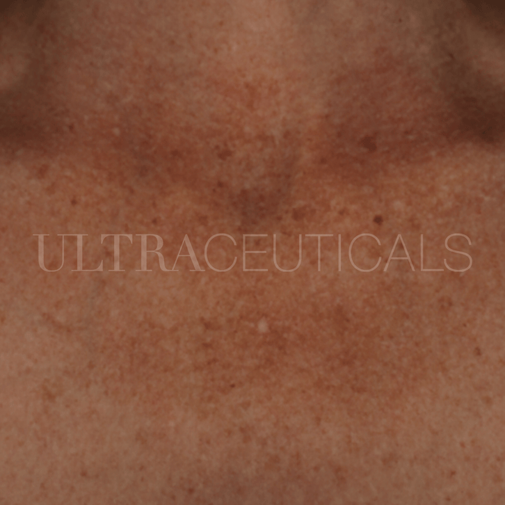 Ultra Retexturising Body Complex Online – Ultraceuticals US